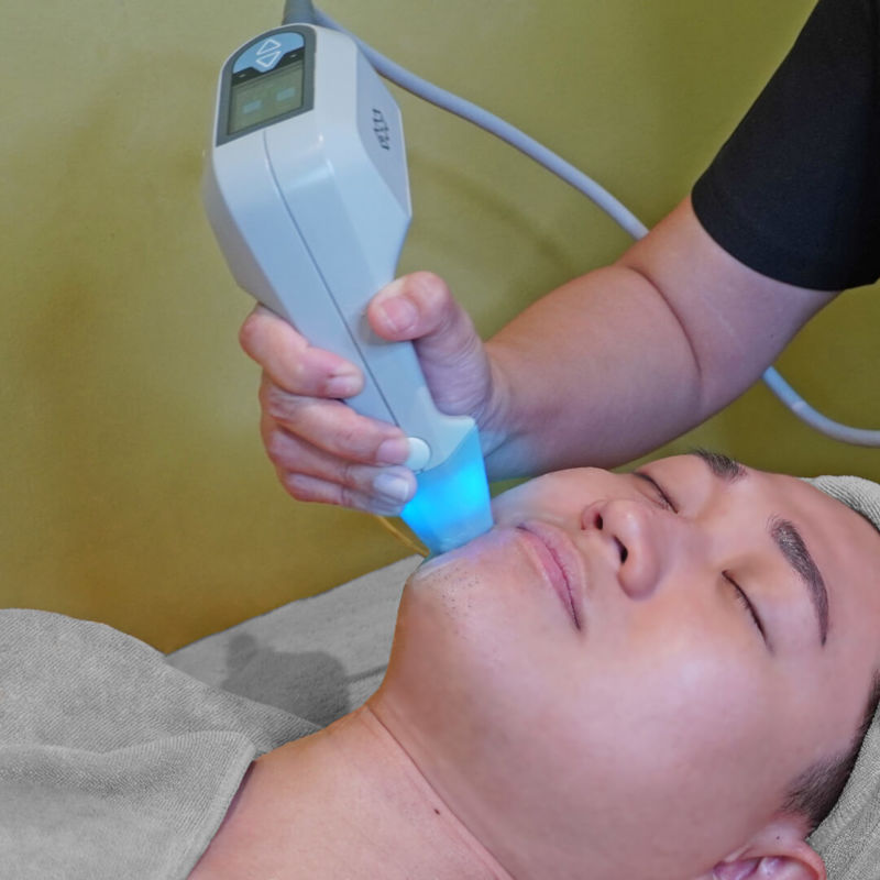 Exilis Face Tightening – Double Chin Be Gone! | Men's Expressions